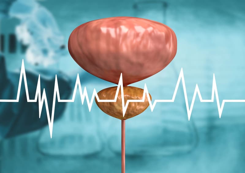 Łagodny rozrost gruczołu krokowego (przerost prostaty)
