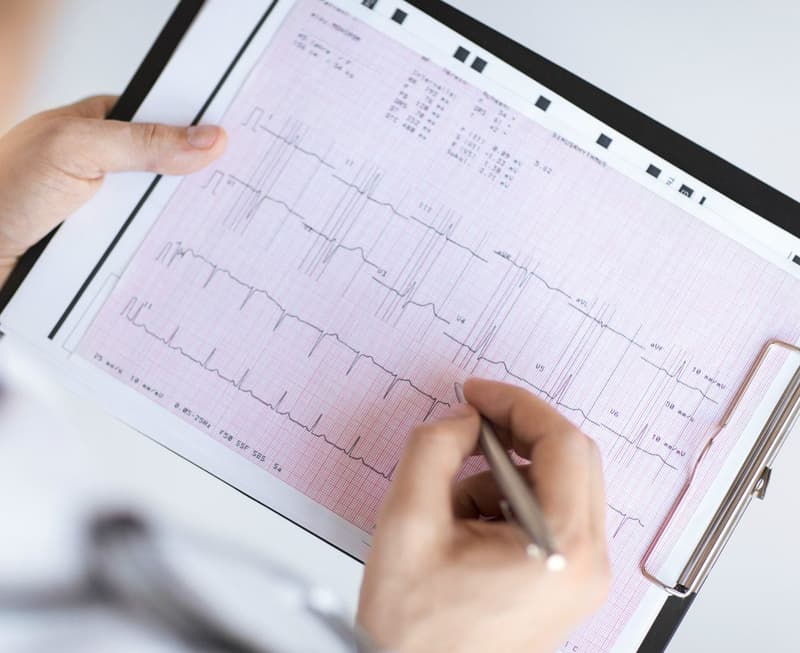Badanie EMG – elektromiografia – co to jest i jak wygląda badanie?