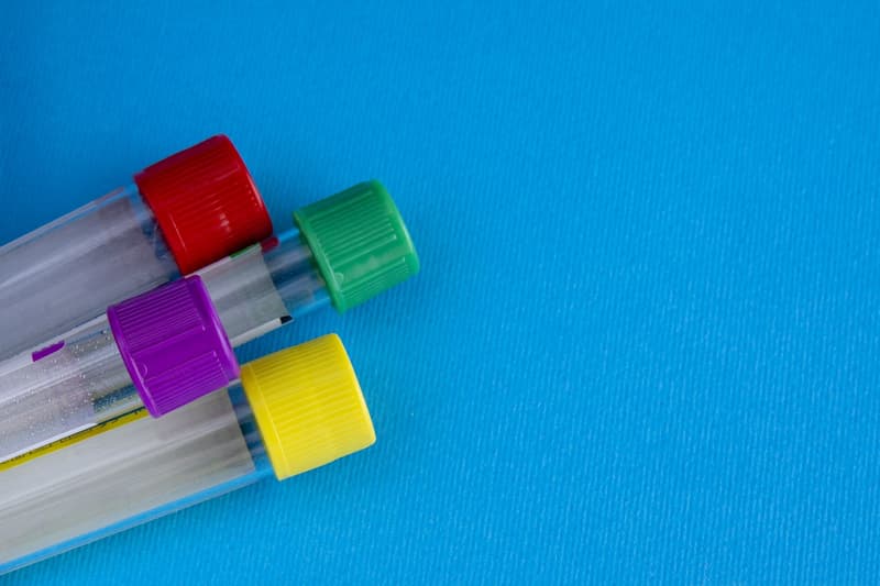 Monocyty podwyższone – co oznaczają w wynikach badania krwi?