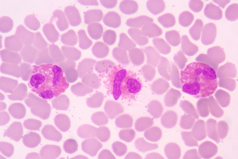 Neutrofile – co oznaczają podwyższone, a co neutrofile poniżej normy?