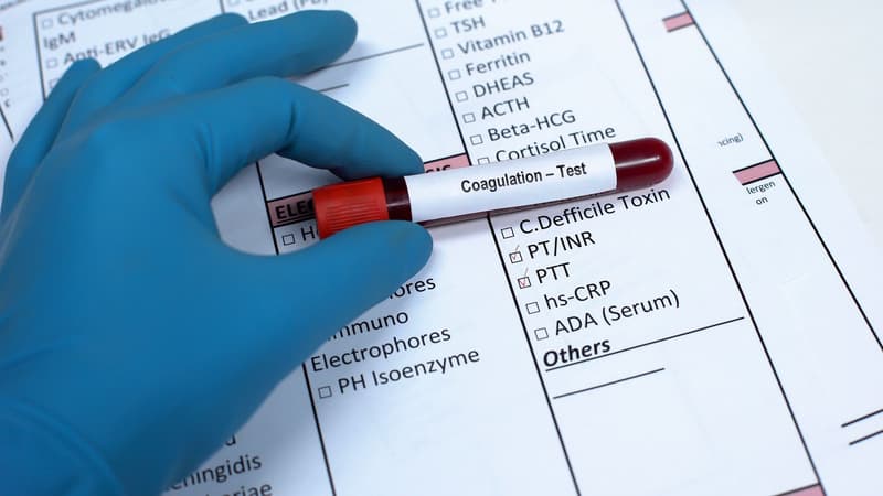 Gliadyna – przeciwciała IgG i IgA – badanie, normy, wyniki, cena