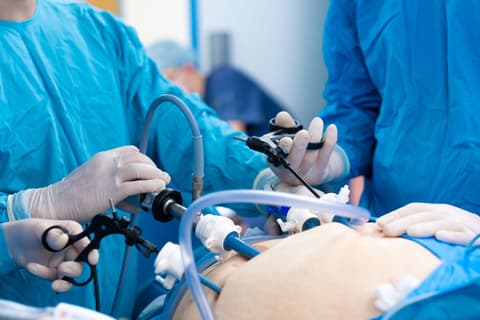 Rektoskopia – czy boli, ile trwa, jak wygląda, kiedy wykonać badanie ...