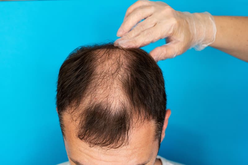 Metformax – jak działa? Wskazania, dawkowanie, skutki uboczne, opinie