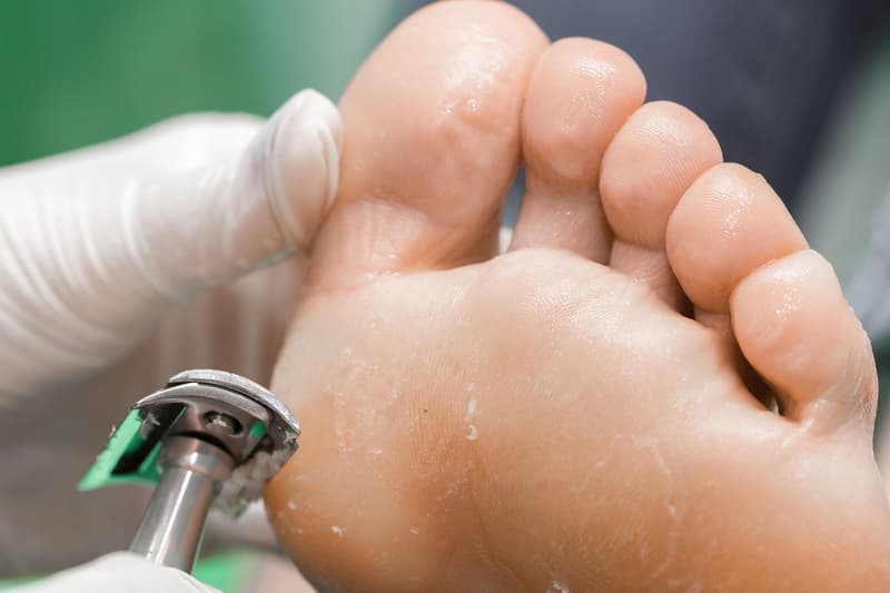 Stopy – budowa, funkcje i najczęstsze schorzenia