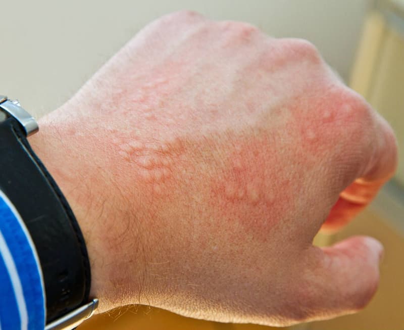 Dexaven – co to jest, działanie, wskazania, przeciwwskazania ...