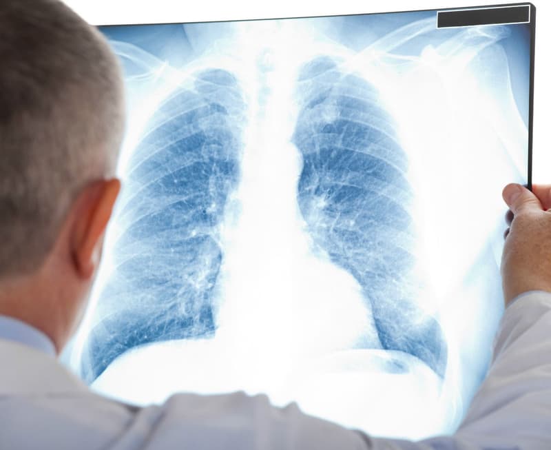 Płuca – gdzie są? Budowa, funkcje, choroby