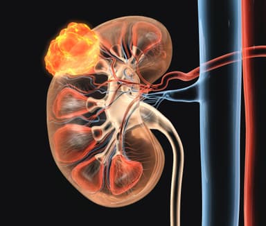 Prostata – co to jest i gdzie się znajduje? Budowa, funkcje, choroby