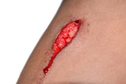 Zapaść – przyczyny, objawy, rodzaje i sposoby leczenia