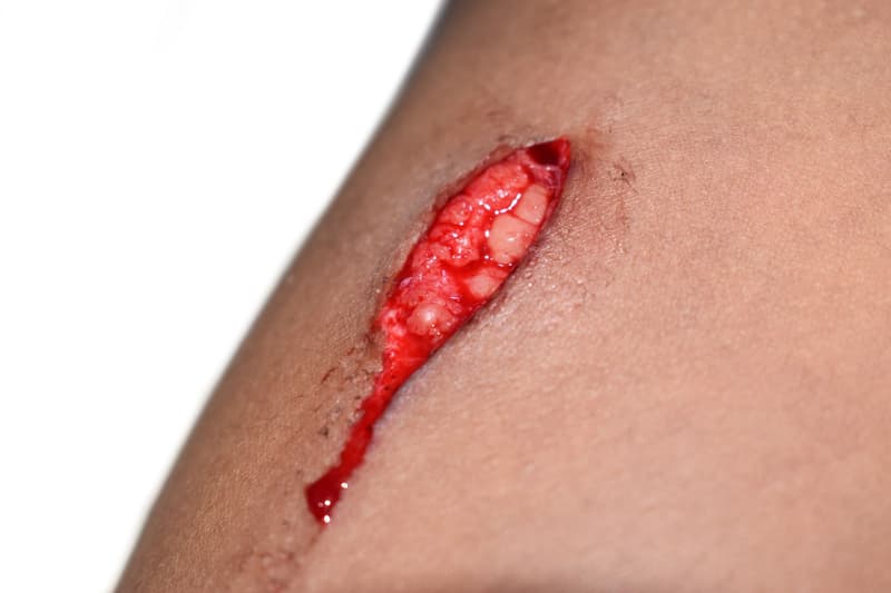 Zapaść – przyczyny, objawy, rodzaje i sposoby leczenia