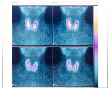 USG prostaty – kiedy warto je wykonać i jak interpretować wyniki?