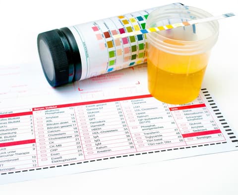 Mastka – co to jest, jak usunąć i się jej pozbyć?