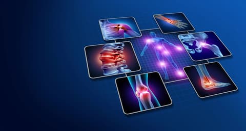 Osteofity kręgosłupa (osteofitoza) – przyczyny, objawy i leczenie ...