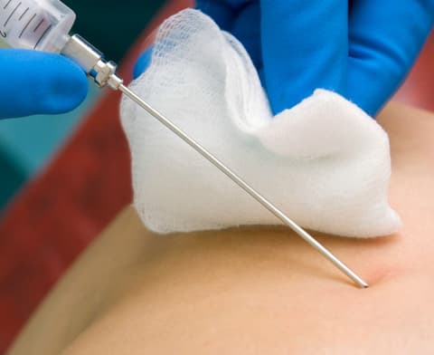 Rektoskopia – czy boli, ile trwa, jak wygląda, kiedy wykonać badanie ...